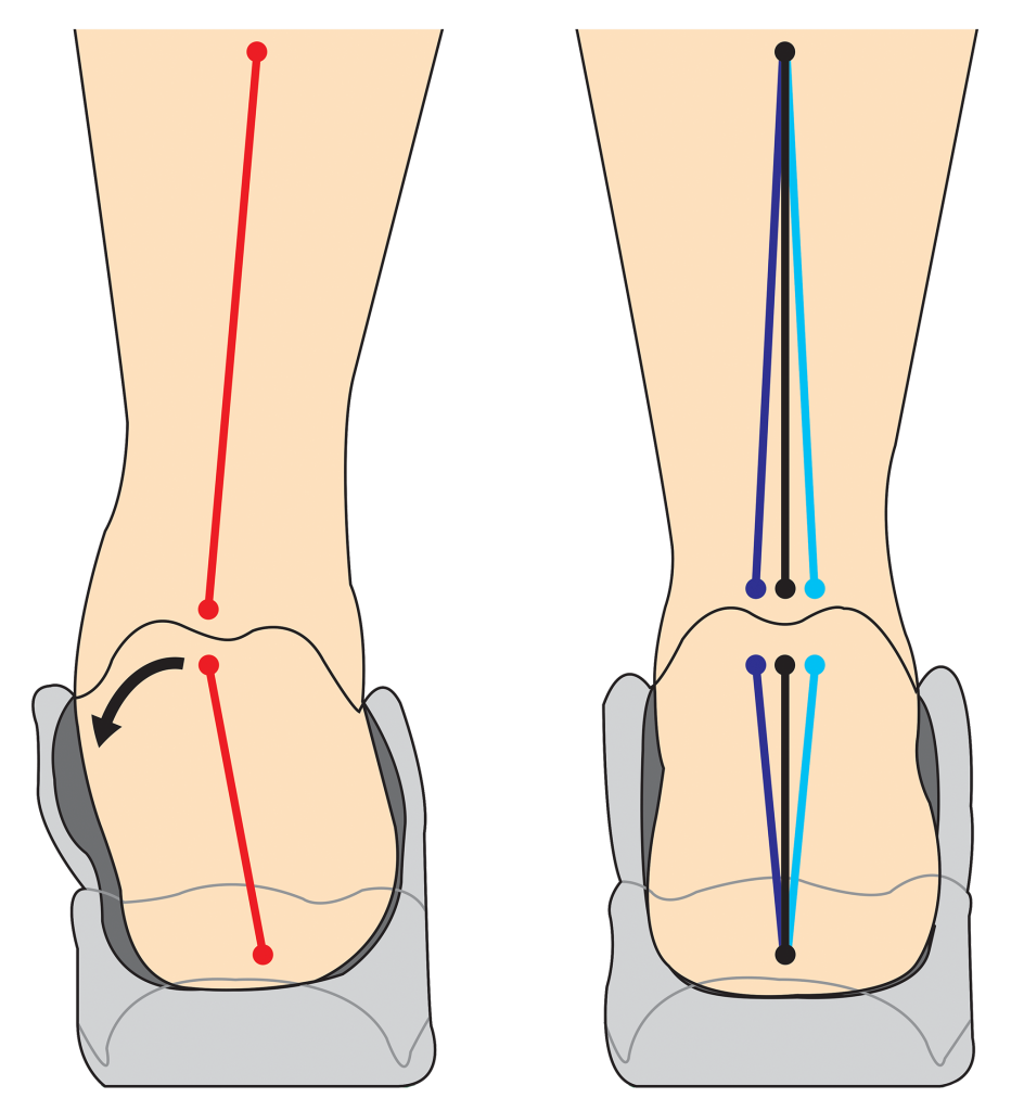 Why FootLibrary - Foot Library®